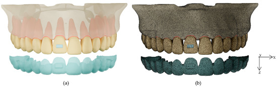 Initial Displacement and Stress Distribution of Upper Central Incisor ...