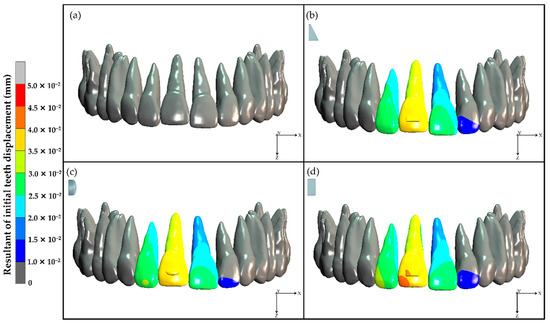 Initial Displacement and Stress Distribution of Upper Central Incisor ...
