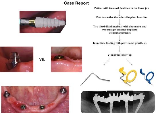 Dentistry Journal | An Open Access Journal from MDPI