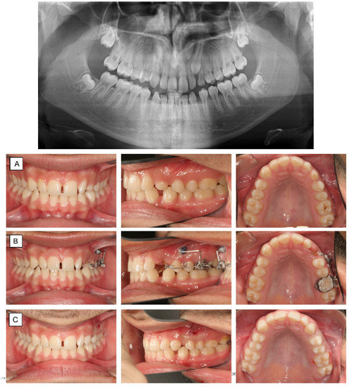 Dentistry Journal | An Open Access Journal from MDPI