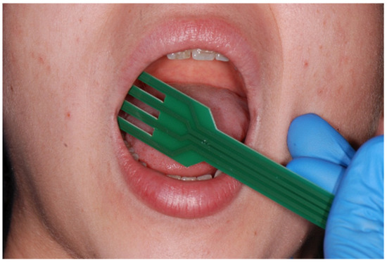 Dentistry Journal | An Open Access Journal from MDPI