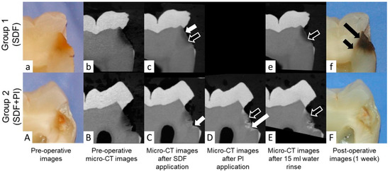 Dentistry Journal | An Open Access Journal from MDPI