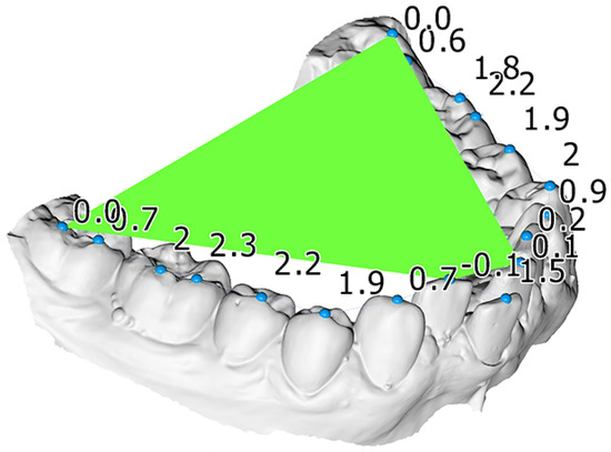 Dentistry Journal | Free Full-Text | Association of Craniofacial ...