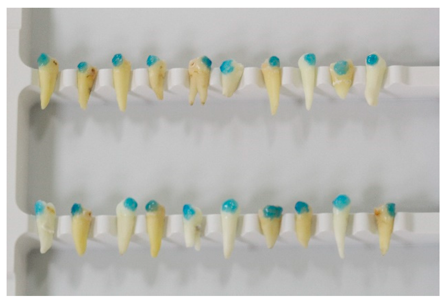 Comparative Evaluation of Two Bracket Systems’ Bond Strength ...