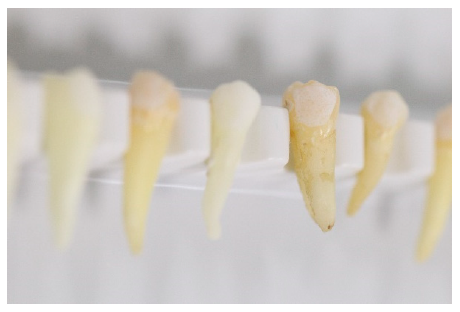 Comparative Evaluation of Two Bracket Systems’ Bond Strength ...