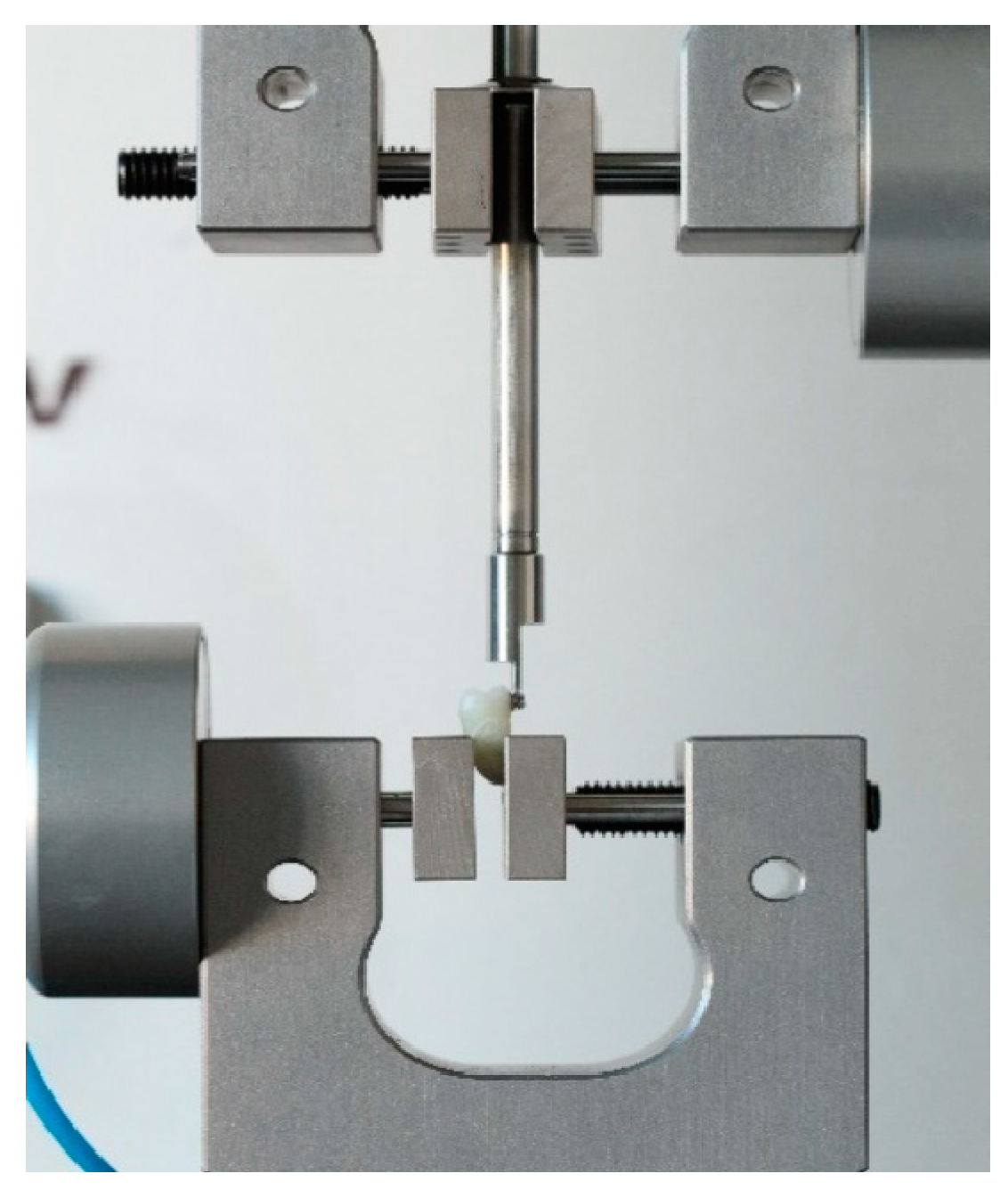 Comparative Evaluation of Two Bracket Systems’ Bond Strength ...