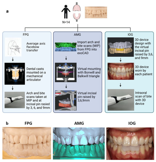 Assessment of Occlusal Vertical Dimension Change in Mechanical and ...