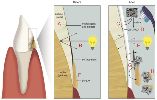 Tooth Whitening with Hydroxyapatite: A Systematic Review