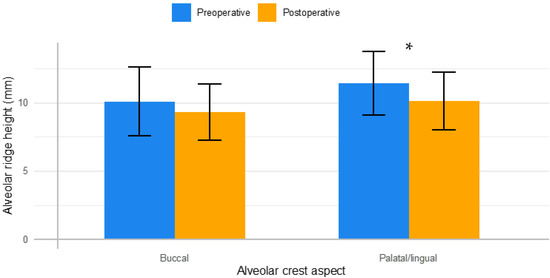 Tomographic Evaluation of Alveolar Ridge Preservation Using Bone ...