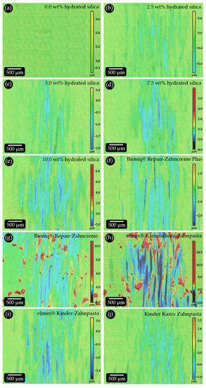 Toothpaste Abrasion and Abrasive Particle Content: Correlating High ...