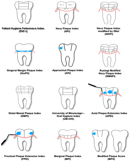Methods for Evaluating the Effectiveness of Home Oral Hygiene Measures ...