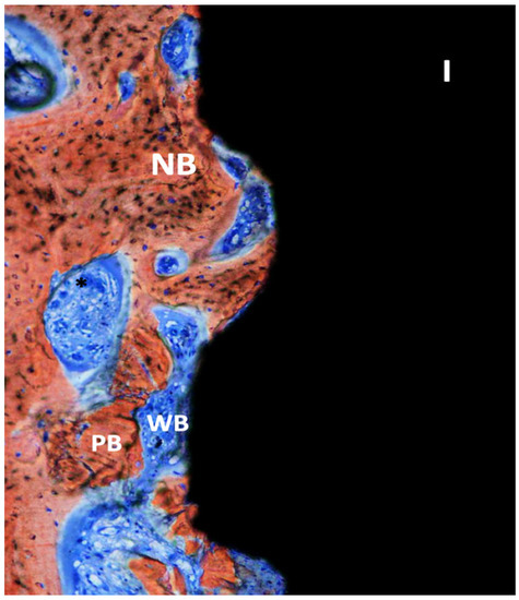 Human Histological Analysis of Early Bone Response to Immediately ...