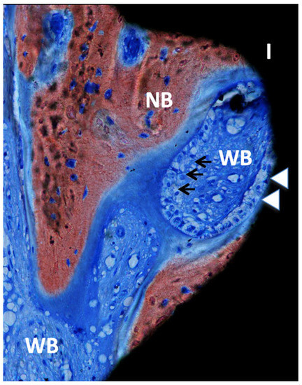 Human Histological Analysis of Early Bone Response to Immediately ...