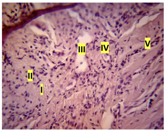 A New Way to Model Periodontitis in Laboratory Animals
