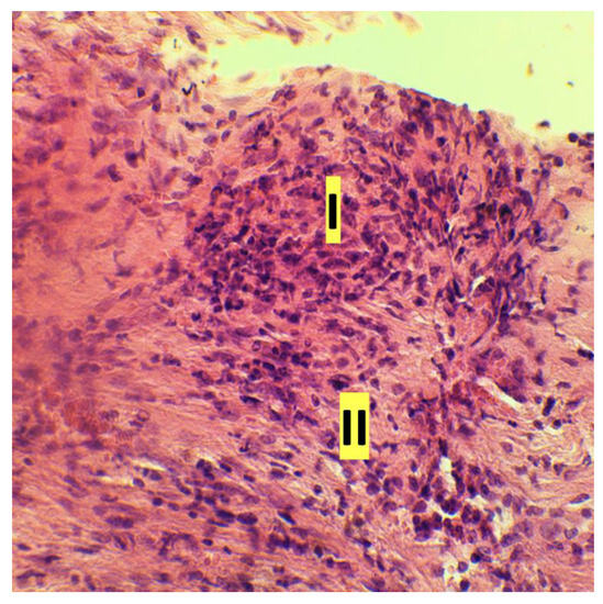 A New Way to Model Periodontitis in Laboratory Animals