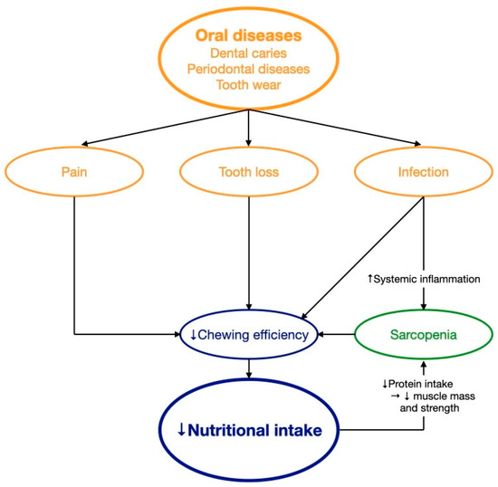 Diet, Nutrition, and Oral Health in Older Adults: A Review of the ...