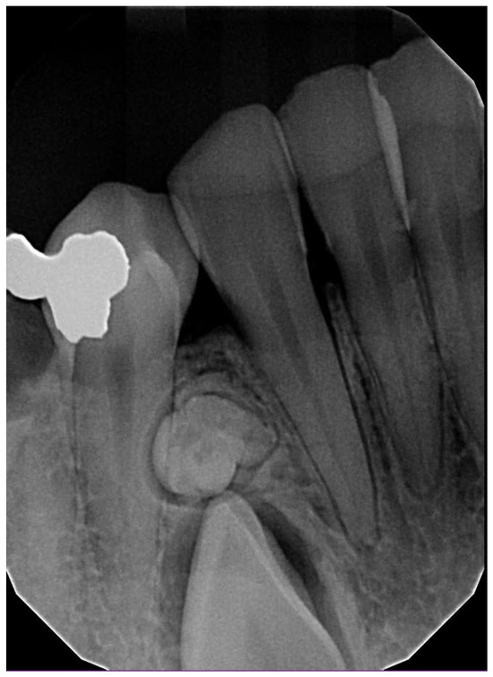 Dentistry Journal | Free Full-Text | Clinicoradiopathologic Analysis of ...