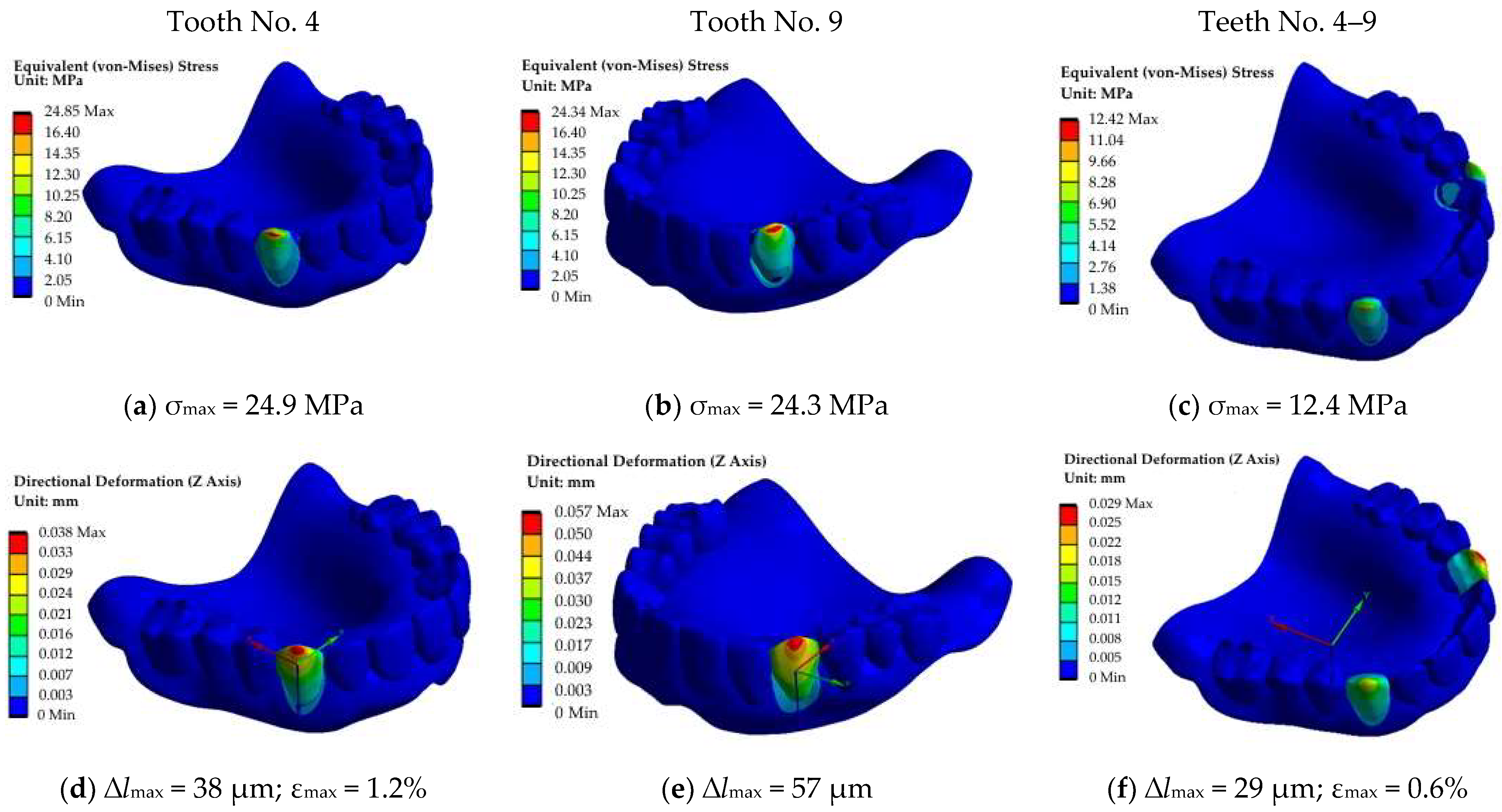 Ranking Technologies of Additive Manufacturing of Removable Complete ...