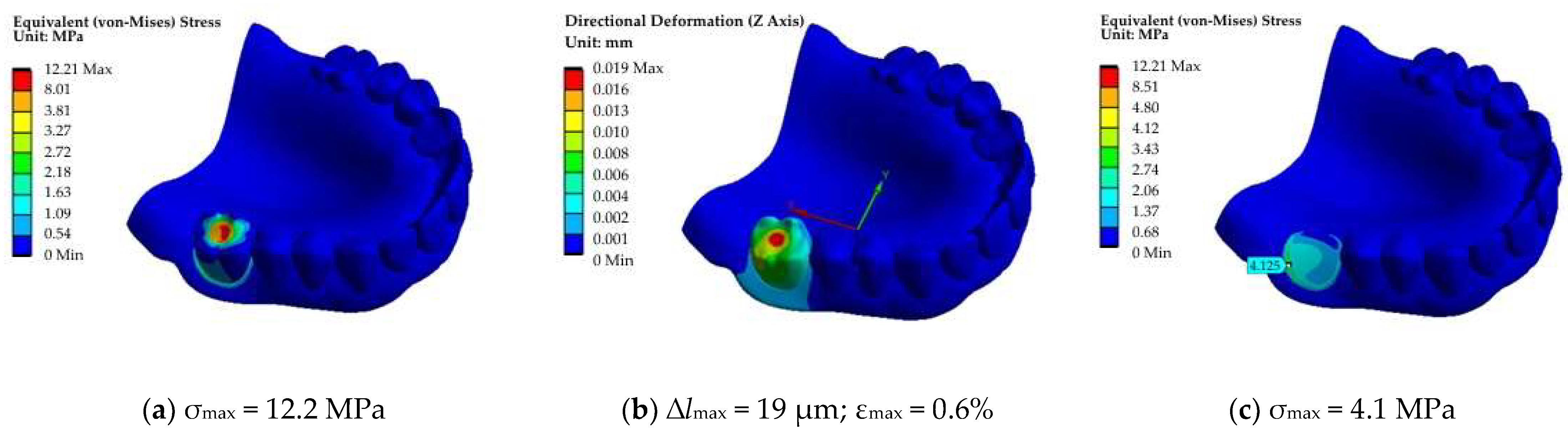 Dentistry Journal | Free Full-Text | Ranking Technologies of Additive ...