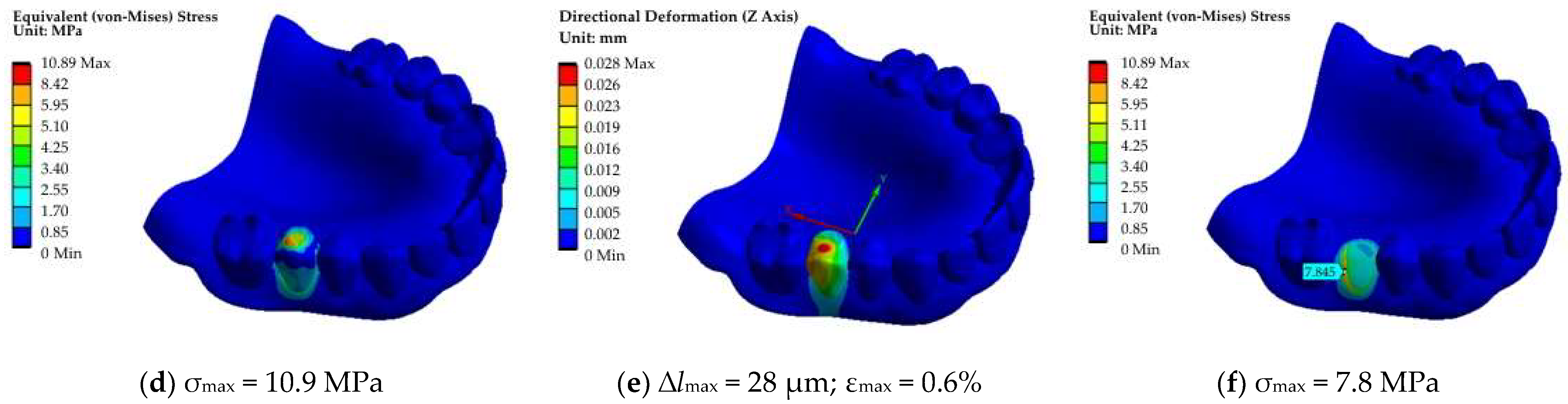 Ranking Technologies of Additive Manufacturing of Removable Complete ...