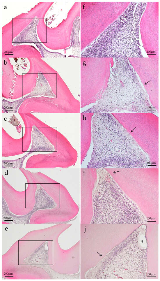 The Effects of Antimicrobial Photodynamic Therapy Used to Sterilize ...