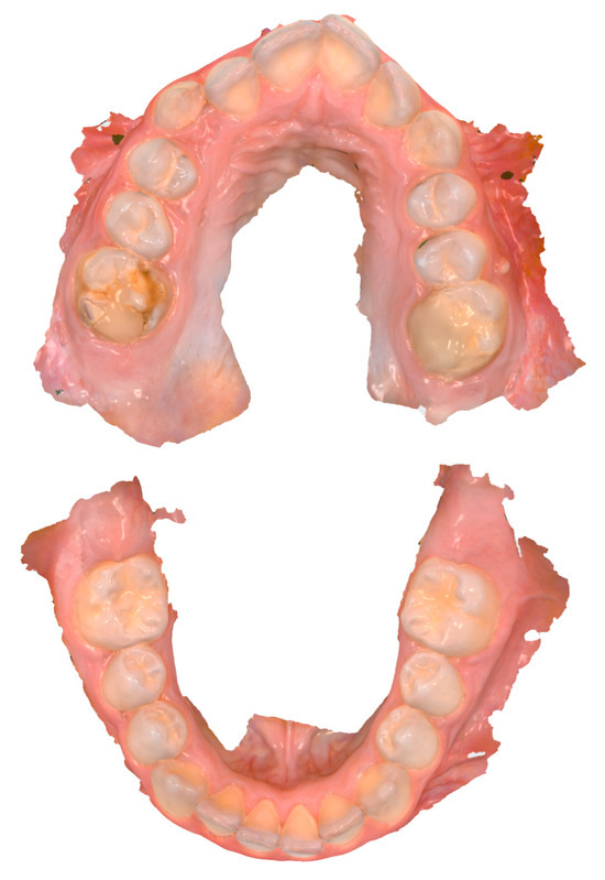 Improving the Communication of Dental Findings in Pediatric Dentistry ...
