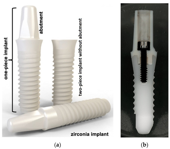 Materials and Methods for All-Ceramic Dental Restorations Using ...