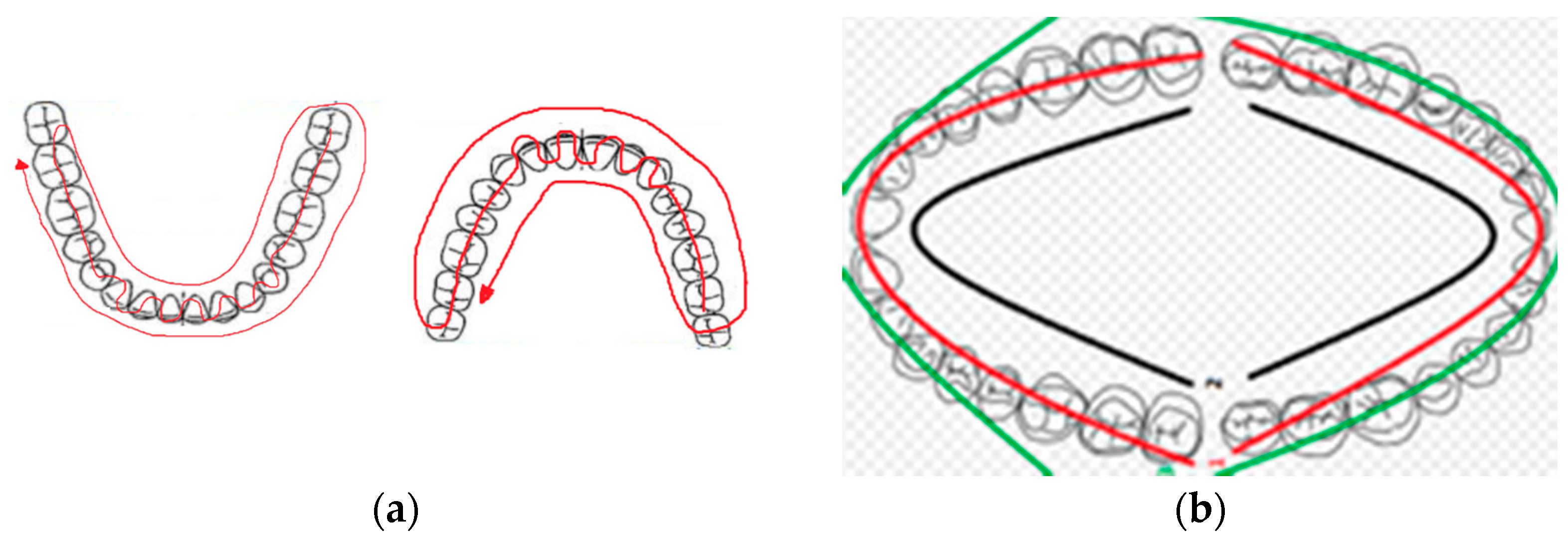 Assessing the Impact of IOS Scanning Accuracy on Additively ...