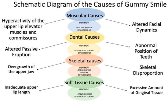 Proposal of a New Therapeutic Classification in Gingival Smiles Focused ...