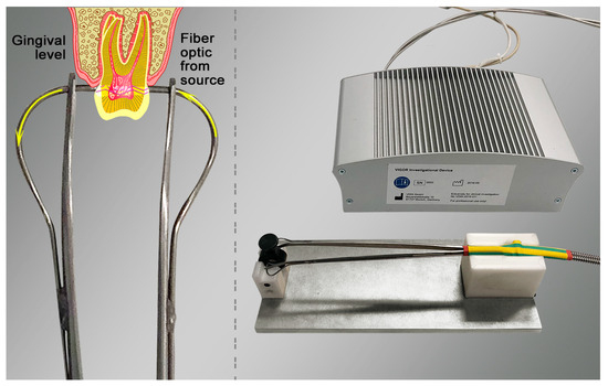 Pulp Vitality Diagnosis by Means of an Optical Pulp Scanning Device