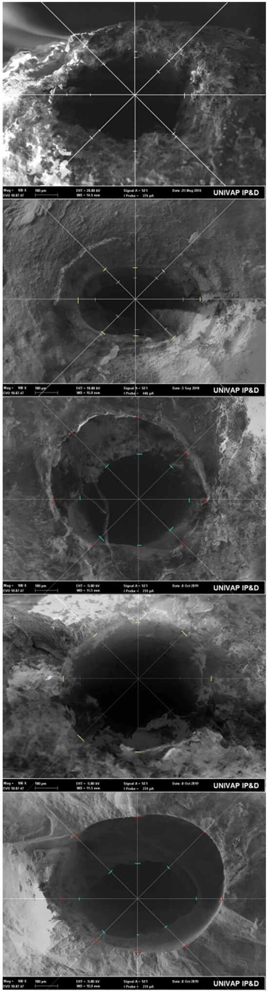 ProDesign Logic Files Effect on Apical Foramen Wear and Shape Transformation After Foraminal ...