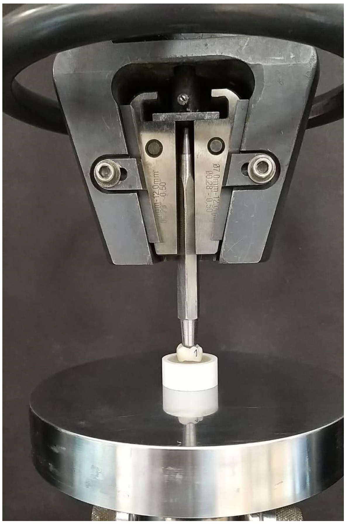 Fracture Resistance and Initial Penetration Time of a Novel Zirconia ...