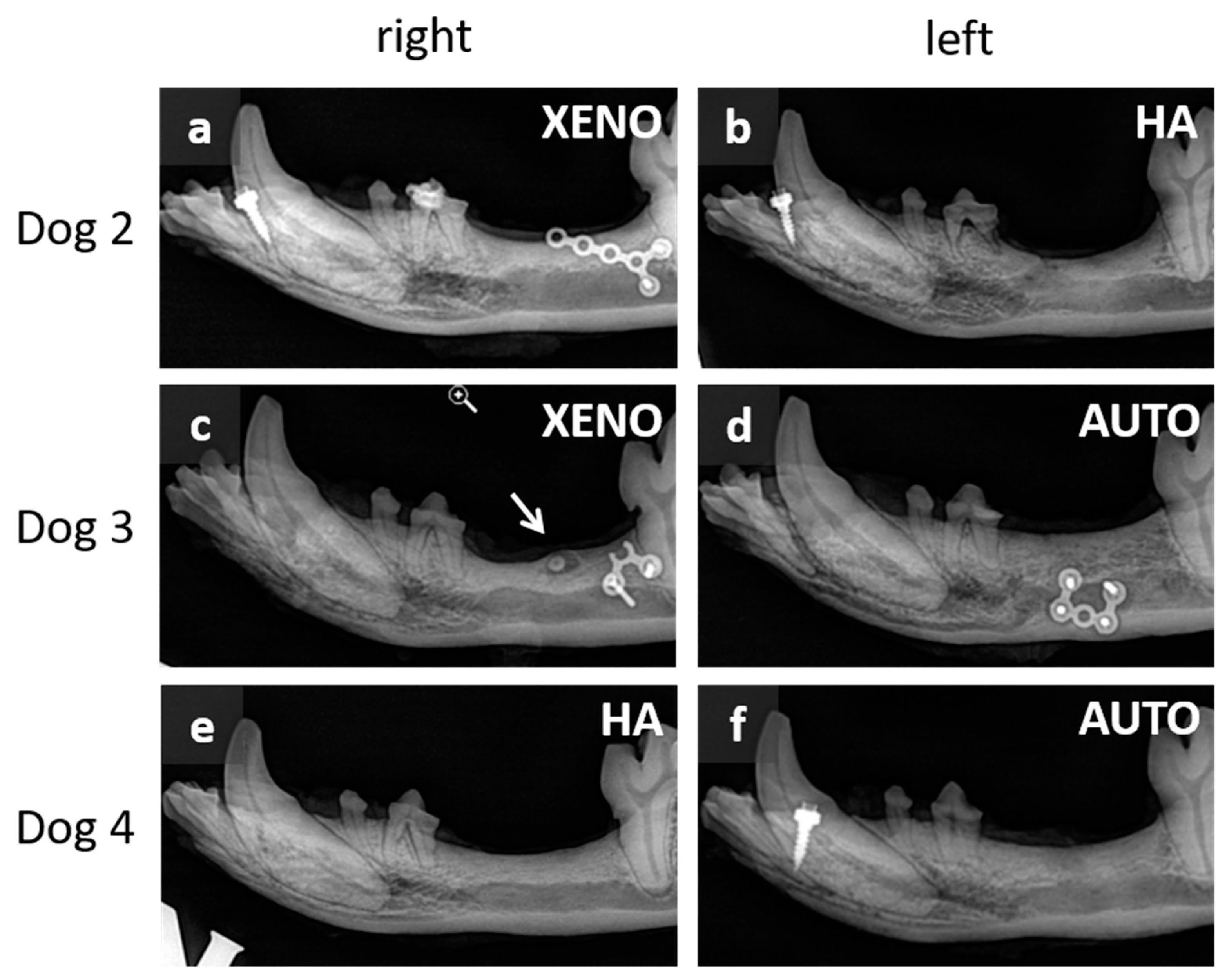 Changes in the Periodontal Gap After Long-Term Tooth Movement into ...