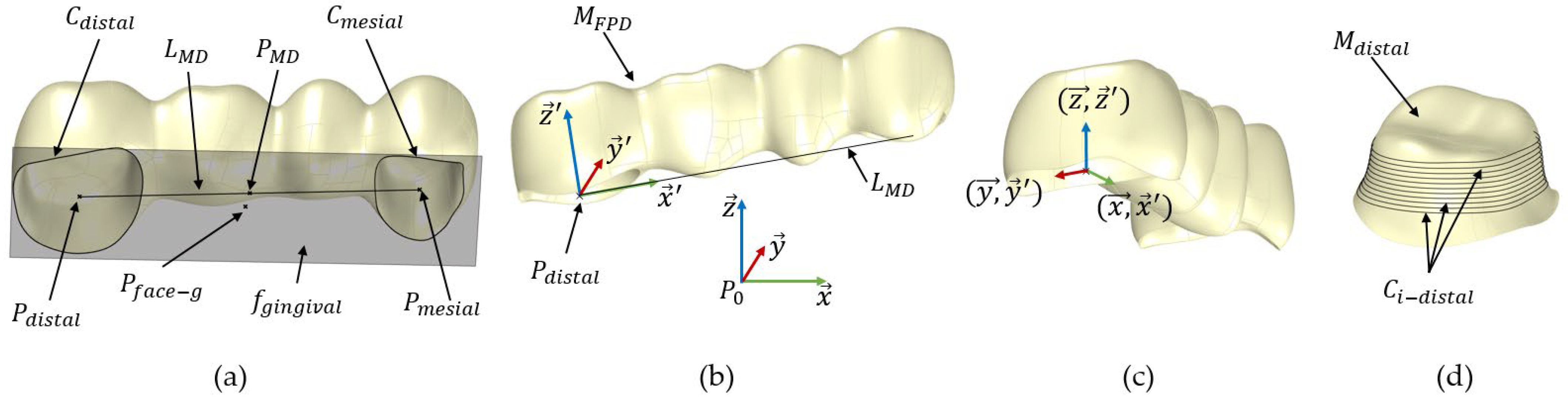 Automated Support Generation for Fixed Partial Dentures and Impact of ...