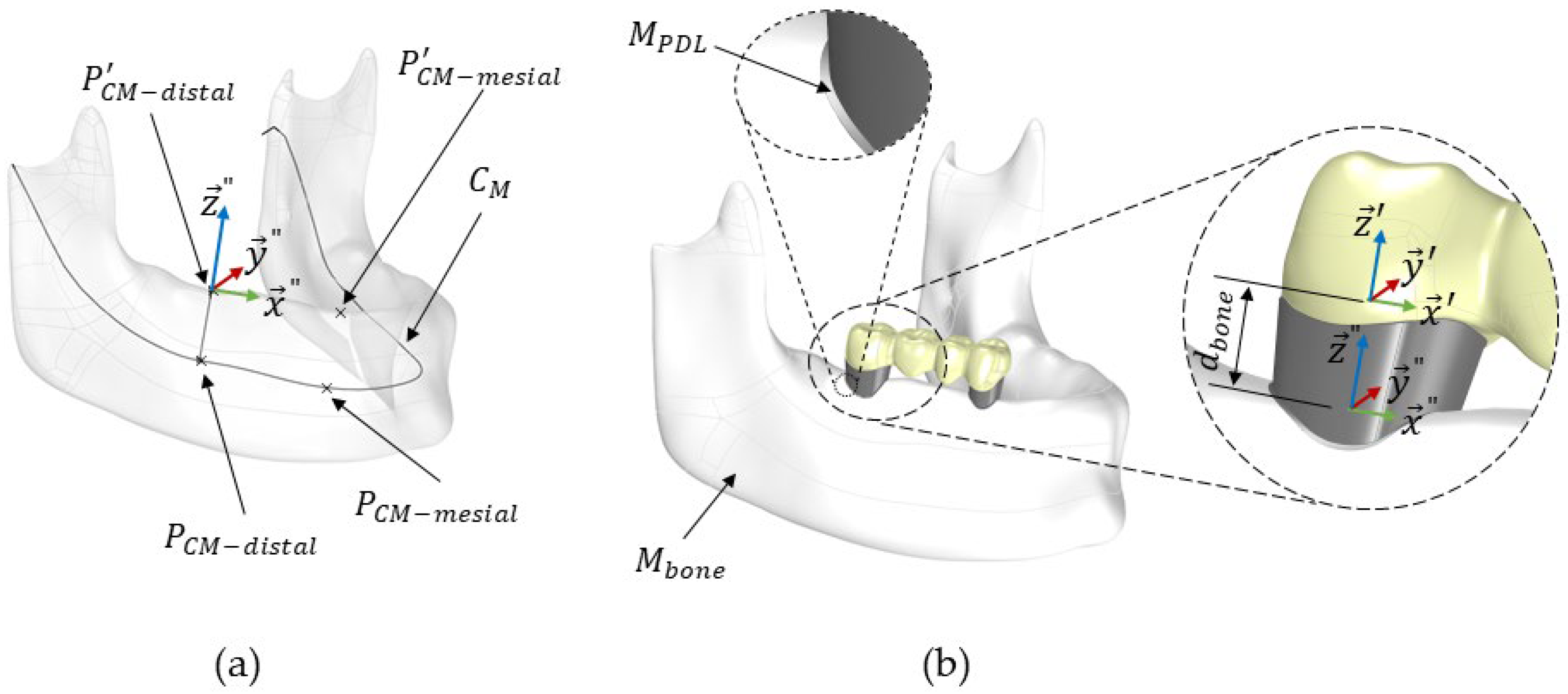 Automated Support Generation for Fixed Partial Dentures and Impact of ...