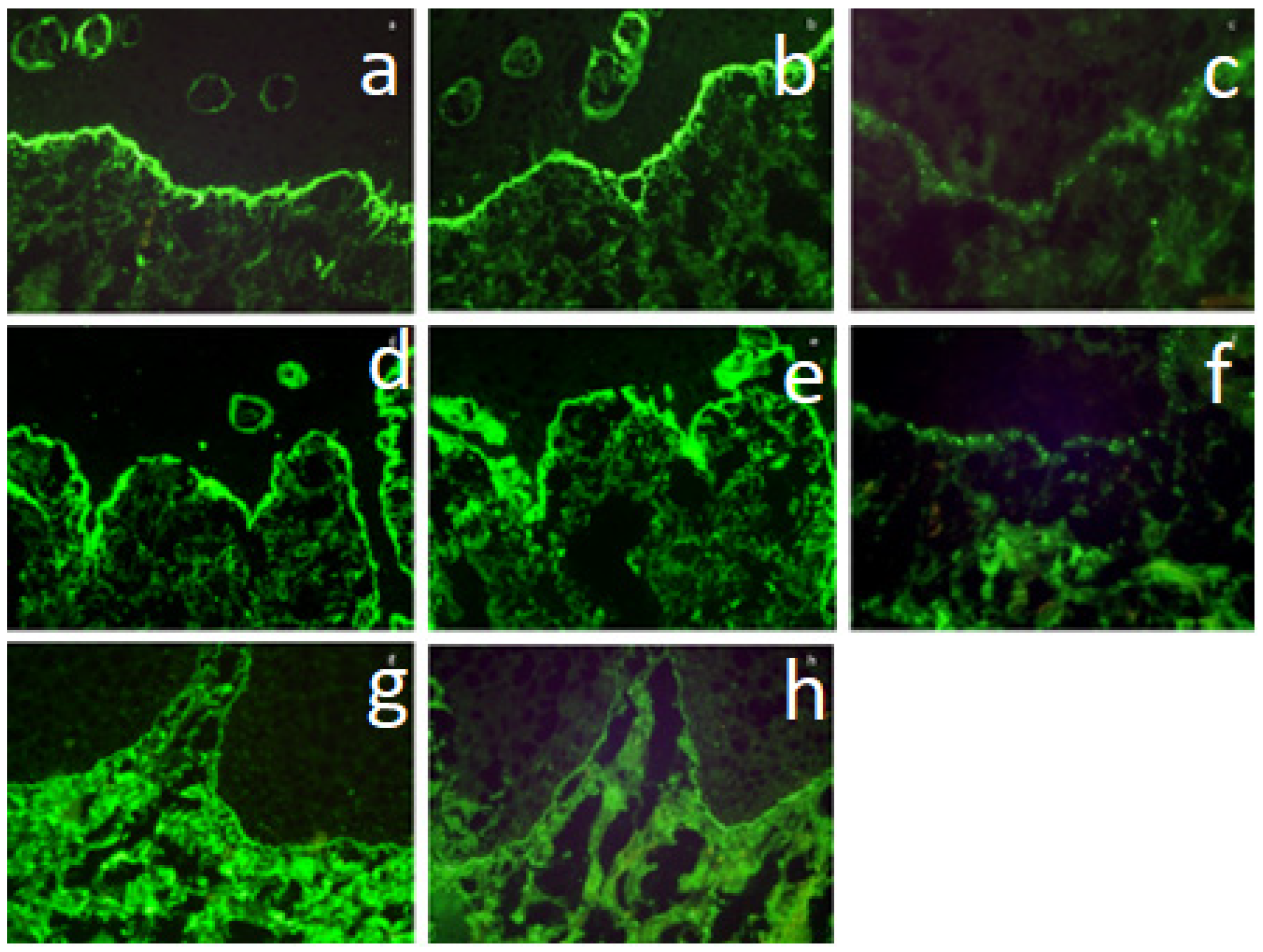 Direct Immunofluorescence in Oral Lichen Planus and Related Lesions ...