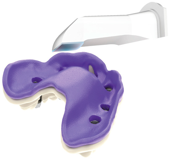 A Novel Intraoral Optical Scan-Transfer Device for Full-Arch Implant ...