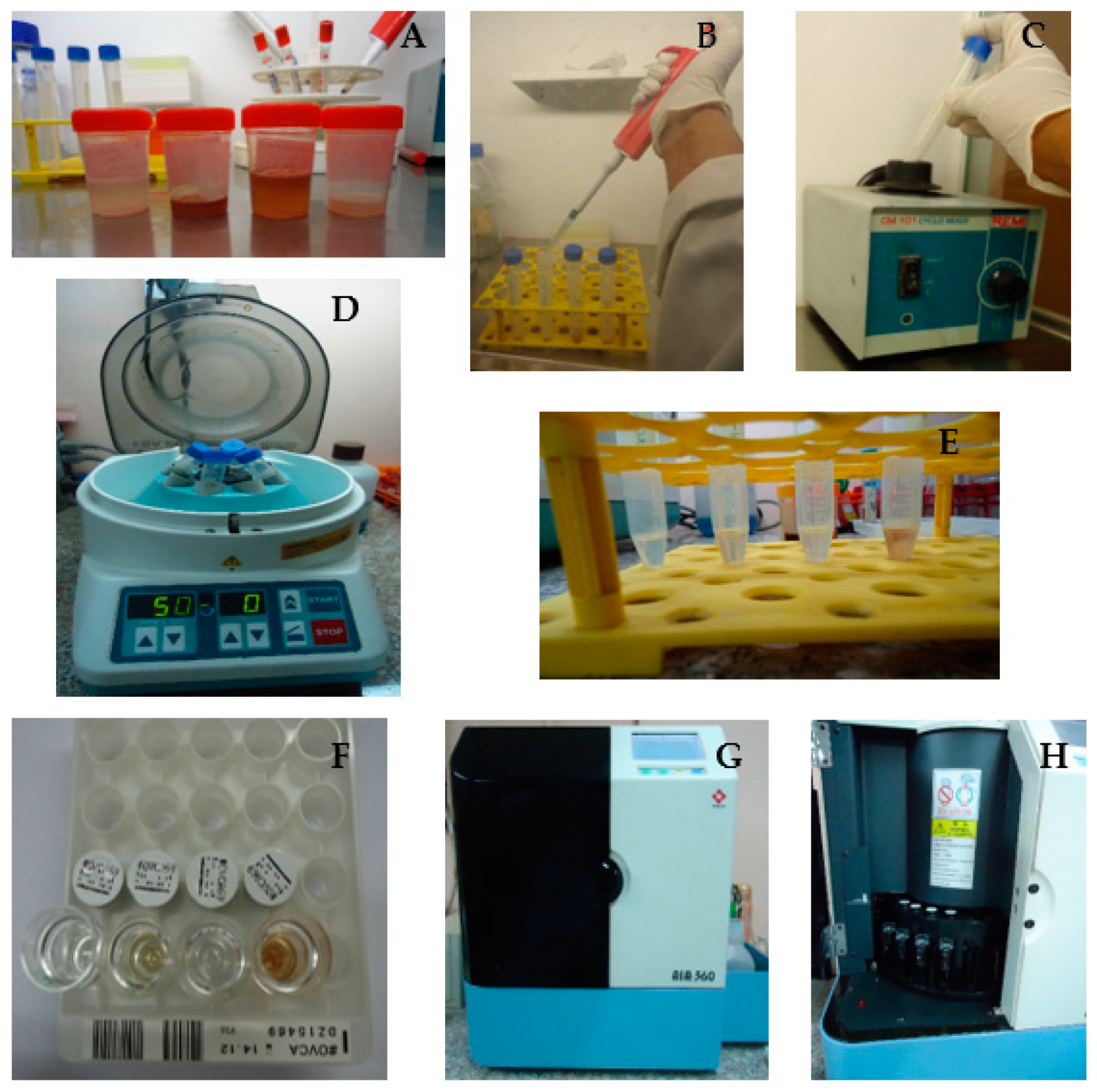 Comparative Analysis of Salivary Tumor Marker CA-125 Among Oral ...