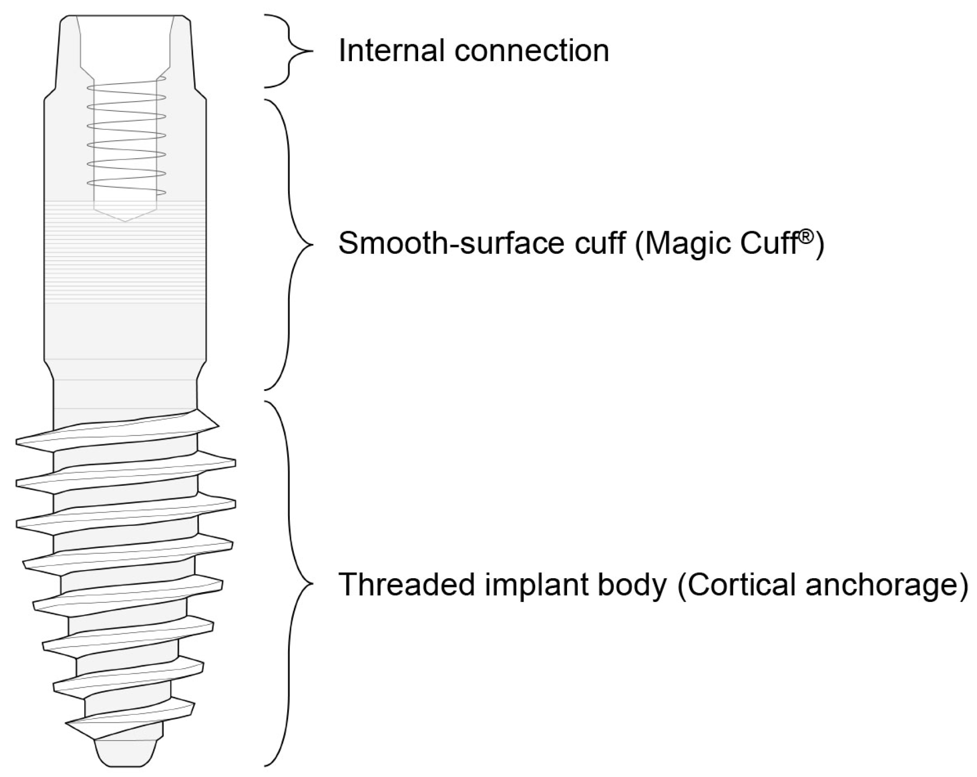 The Clinical Application of the ARi® Implant System in Severely ...