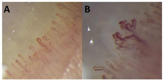 Dermato | An Open Access Journal from MDPI