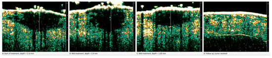 Understanding the Importance of Daily Imaging in the Treatment of Non ...