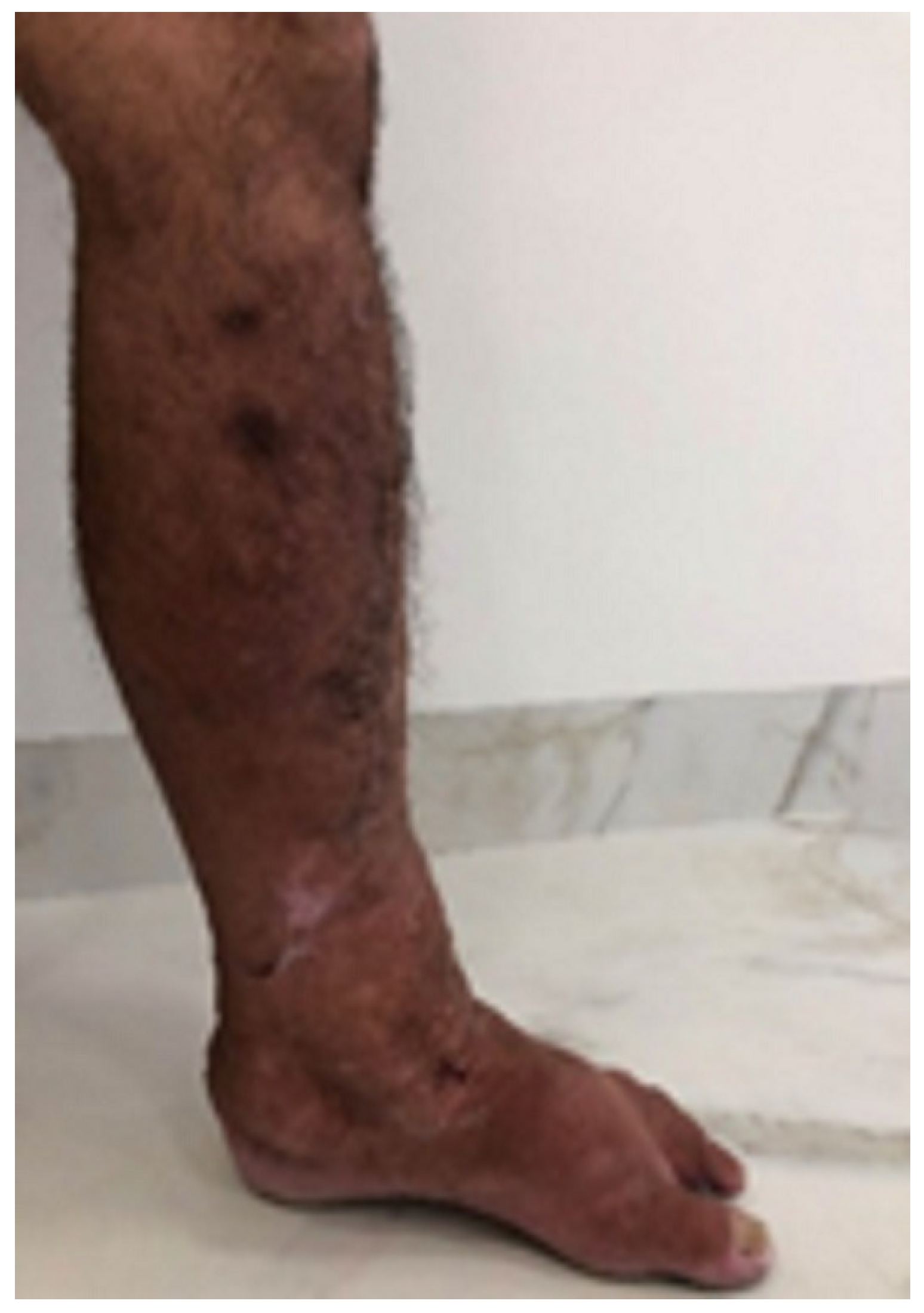 Stimulation of Synthesis and Lysis of Extracellular Matrix Proteins in ...