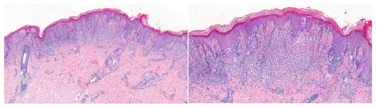 Dermatopathology | An Open Access Journal from MDPI