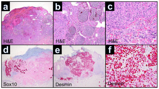 Dermatopathology | An Open Access Journal from MDPI