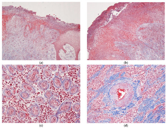 Dermatopathology | An Open Access Journal from MDPI