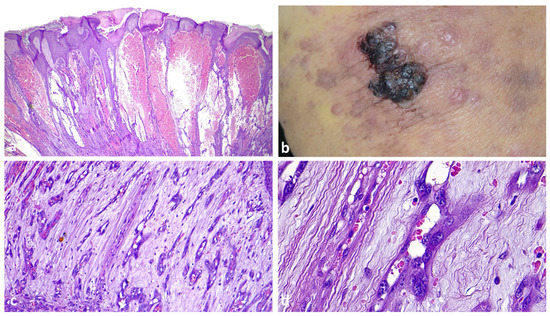 A Clinico-Pathological Multidisciplinary Team Increases the Efficacy of ...