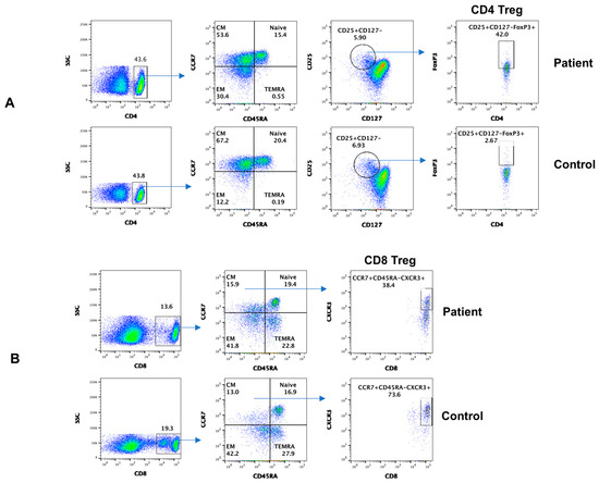 Dermatopathology | Free Full-Text | IgG4-Related Disease (IgG4-RD) with ...