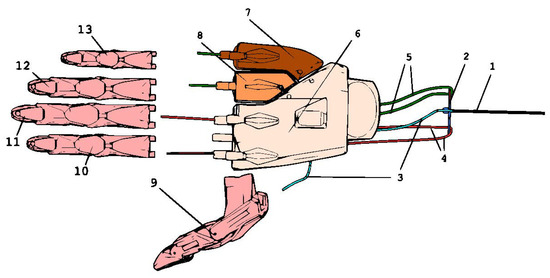 Karla: A Simple and Affordable 3-D Printed Body-Powered Prosthetic Hand ...