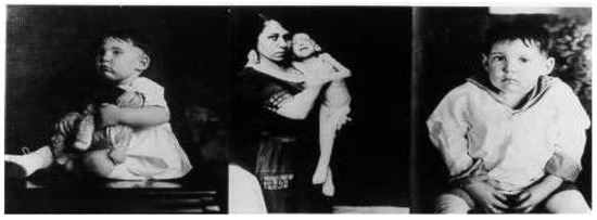 Insulin Past, Present, and Future: 100 Years from Leonard Thompson