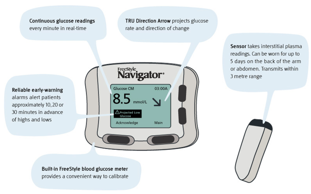 Diagnostics | Free Full-Text | Continuous Glucose Monitoring Systems: A ...